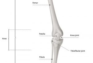 Lateral Release Surgery for Patellofemoral Problems - Connecticut ...